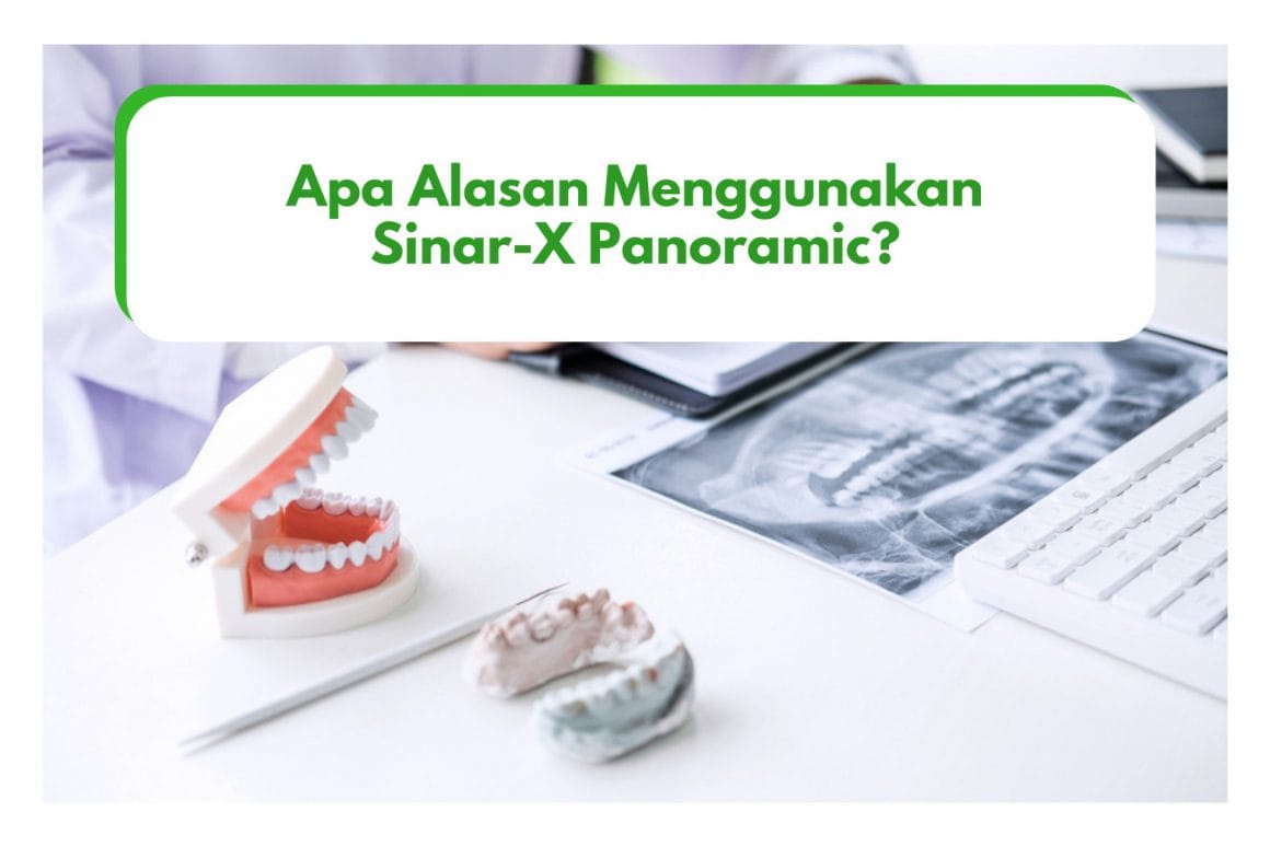 Alasan Menggunakan Sinar-X Panoramik dan Fungsinya